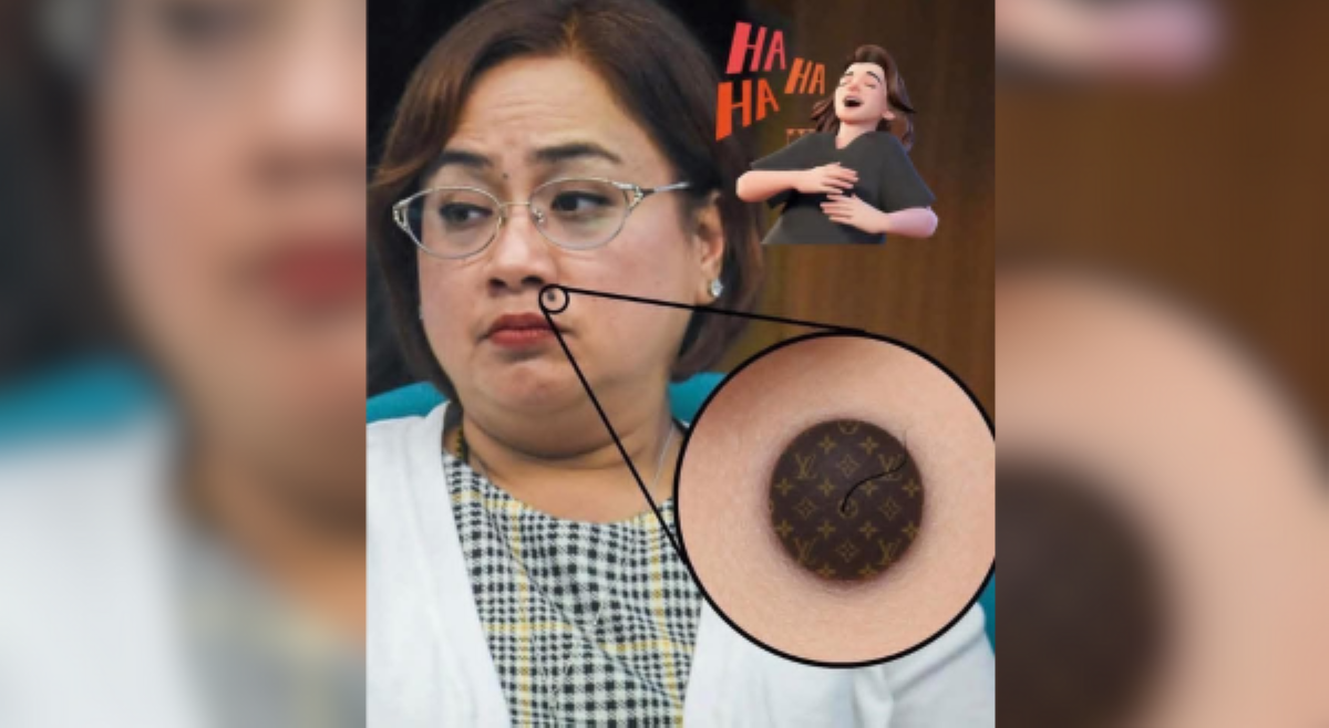 Sey ng netizens, nunal ni Sarah Discaya, luxury din!-Balita