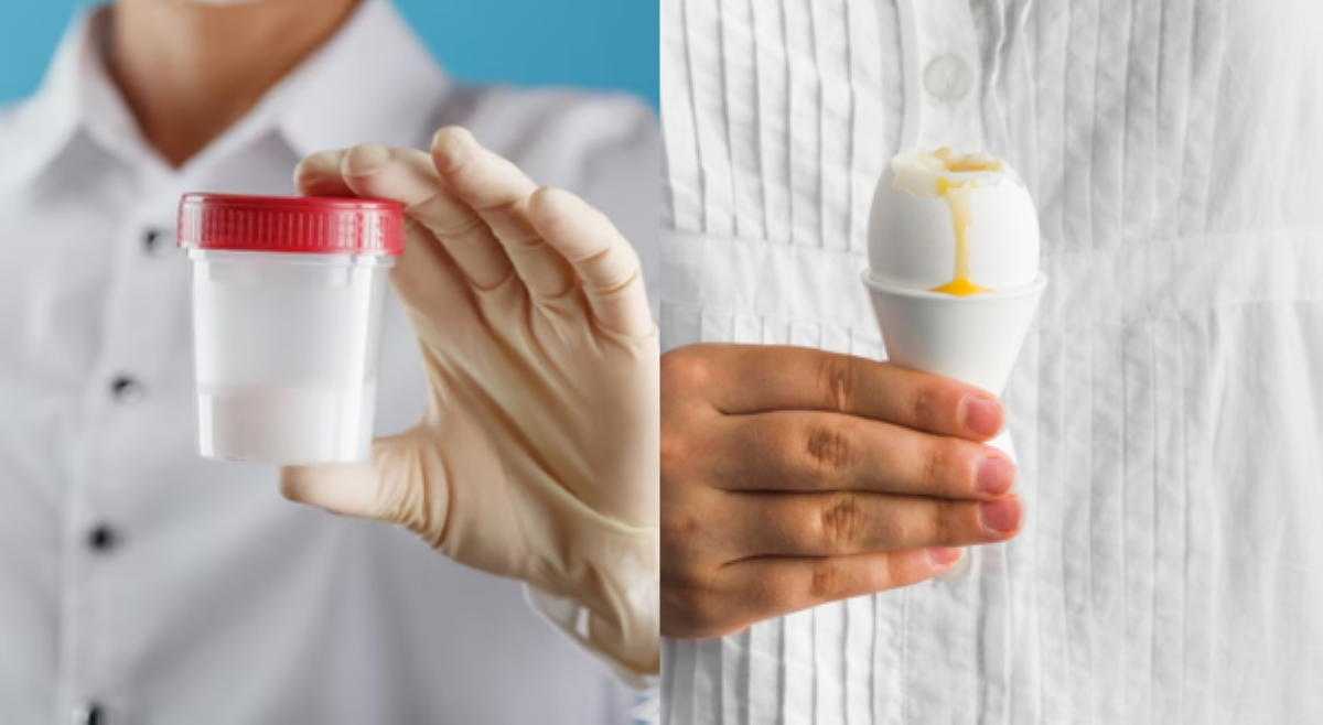 ALAMIN: Bakit 'dilaw' minsan ang kulay ng semilya?-Balita